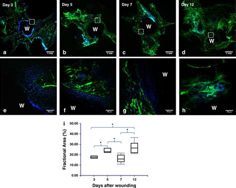 In Vivo Laser Speckle Imaging Reveals Microvascular Remodeling And
