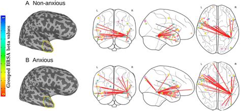 Left Grouped Bayesian Representational Similarity Analysis Of Region Download Scientific