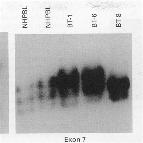 Genomic Sequencing Of Exons 5 8 Of The P53 Gene In Human Breast Download Scientific Diagram