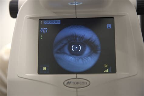 УЛТРАЗВУК Denica Mk