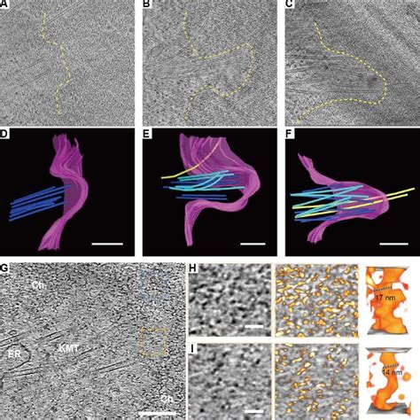 Centromeric Chromatin Forms A Pocket Like Structure In The Mitotic Download Scientific Diagram