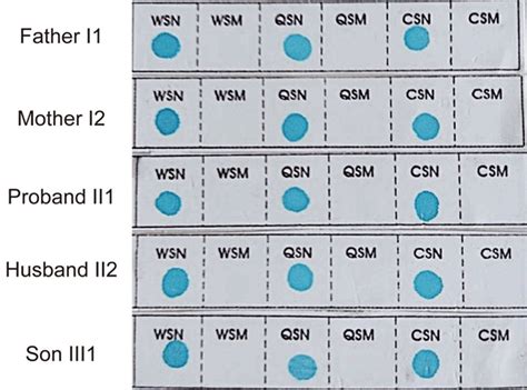 Reverse Dot Blot Hybridization Rdbh Assay Analysis Of The α Qs α α Download Scientific
