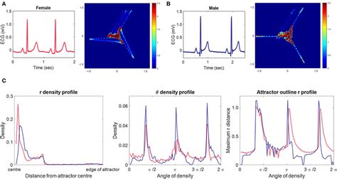 Typical Female And Male Ecg Signals Their Corresponding 3 Point