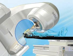 Linear Particle Accelerator Linear Accelerator All Medical Device Manufacturers