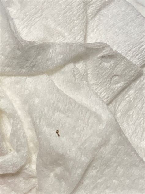 진짜 엄청 작은 벌레 지식in