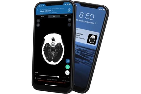 A I Viz Lvo A I Detection Suspected Large Vessel