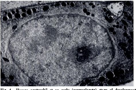 Figure 4 From Ultrastructural Localization Of Myeloperoxidase In Human
