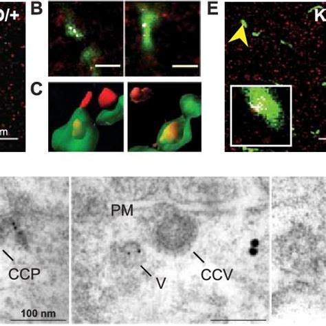Pdf Synaptic Pruning By Microglia Is Necessary For Normal Brain Development