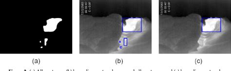 Figure 3 From Non Contact Respiration Monitoring And Body Movements