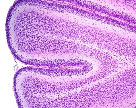 Granular Layer Stock Illustrations 108 Granular Layer Stock