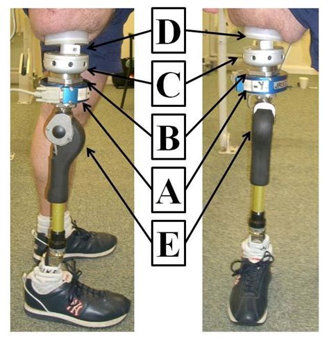 Side Left And Front Right Views Of The Prosthetic Limb Including A