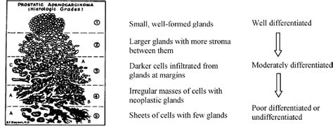Figure 1 From Histology Image Analysis For Carcinoma Detection And