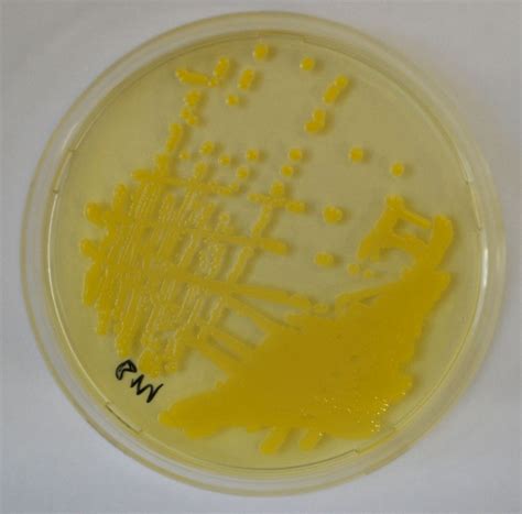 Indemnisation Des Conséquences Dun Staphylocoque Doré