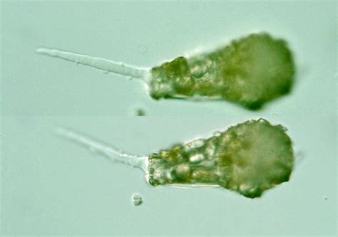 Protist Images Difflugia Oblonga