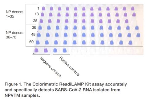 Colorimetric Assay Results Differentiate Between Sars Positive Blue Download Scientific