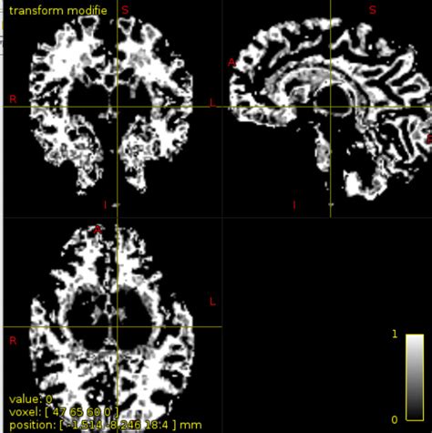 Neonatal Brain Structural Connectome Tractography Mrtrix3 Community