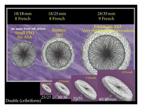 Family Of Amplatzer PFO Occluders The Right Left Numbers Indicate The Download Scientific