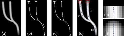 Process Of Subpixel Detection A Original Image With A Stripe B