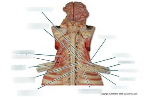 Brachial And Cervical Plexus Diagram Quizlet
