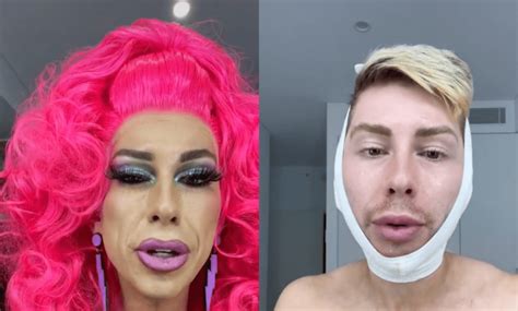 Un Artista Drag Responde A Los Comentarios De Odio Tras Hacerse Un Lifting Cromosomax