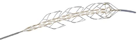 Embotrap Revascularization Device Download Scientific Diagram