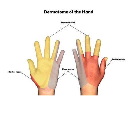 Printable Sensory Dermatome Of Hand Printable Jd