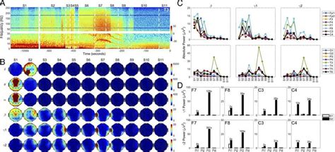 Surge Of Neurophysiological Coupling And Connectivity Of Gamma Oscillations In The Dying Human