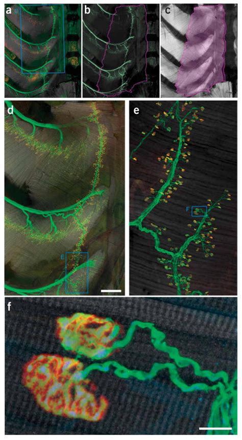 Ex Vivo Imaging Of Motor Axon Dynamics In Murine Triangularis Sterni