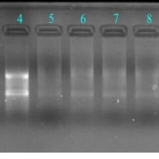 After Manipulation Total RNA Extracted By Different Commercial Kits Download Scientific Diagram