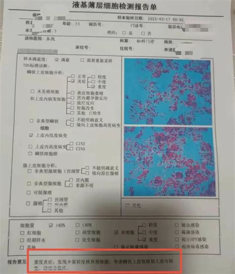 Hpv