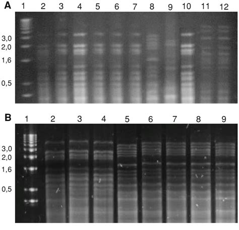 Patterns Generated By Mitochondrial Dna Rflp With Hinfl Restriction
