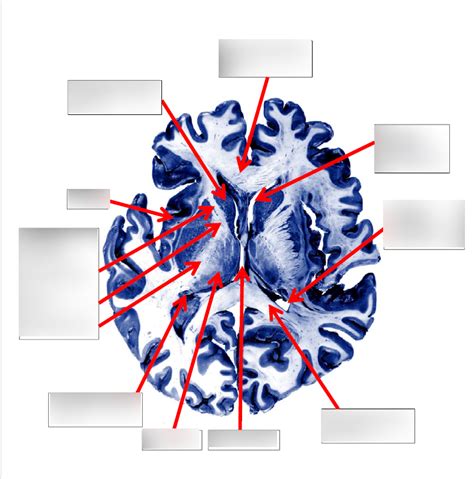 Diagram Of Brain Slices Horizontal Quizlet