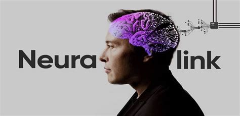 Neuralink Faz 1º Implante De Chip Cerebral Em Humano Diz Elon Musk Portal Viu