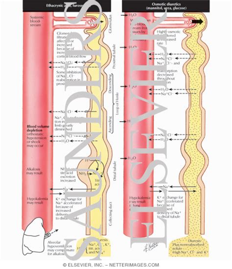 Diuretics Osmotic Osmotic Diuretics