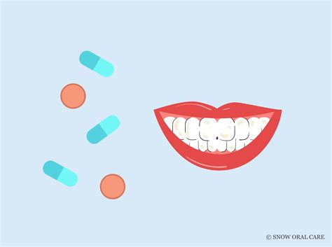 Doxycycline Yellow Teeth Quick Fixes At Home