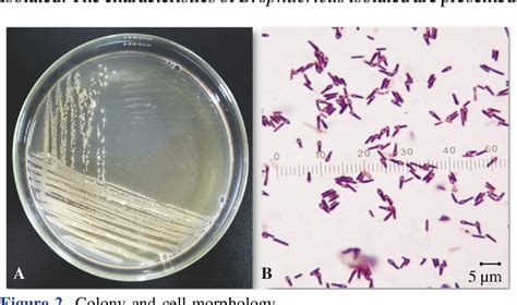 Bacillus Sphaericus Official Supplier Brunofuga Adv Br
