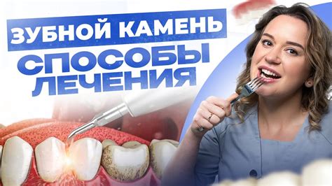 3 способа удаления зубного камня в домашних условиях и их последствия Youtube