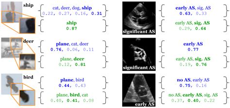 논문 리뷰 Reliable Multi View Learning With Conformal Prediction For Aortic Stenosis