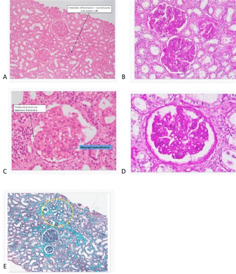 Glomerular Basement Membrane Histology Normal Histology Teaching