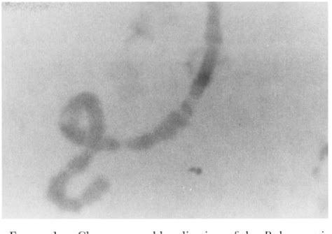 Figure 1 From A Novel Drosophila Minute Locus Encodes Ribosomal Protein S13 Semantic Scholar