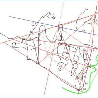 Angular And Linear Measurements Used In The Study Angular Measures Download Scientific