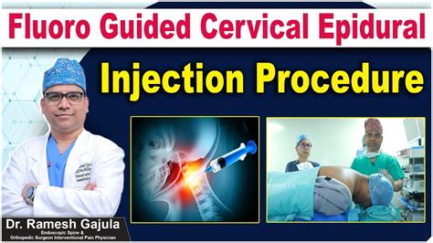 Fluoro Guided Cervical Epidural Injection Cervical Epidural Injection Procedure Panacea