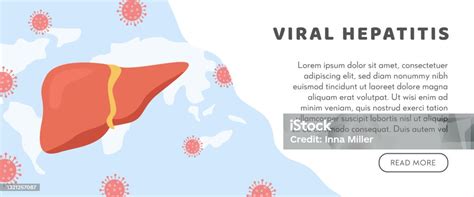 A형 간염 B C D 간경변 세계 간염의 개념 세계지도와 바이러스에 의해 공격 건강한 인간의 간 웹 수평 배너 템플릿 바이러스 성 간염에 대 한 의료 포스터 벡터 7월에