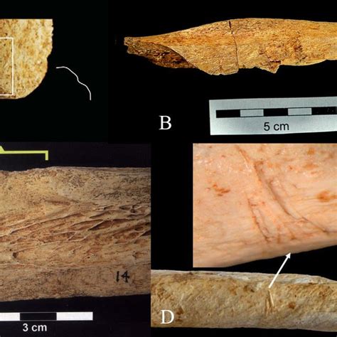 Ct Cross Sections Comparing Perimortem And Postmortem Fractures In The