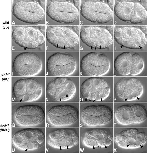 Spd 1 Is Required For The Formation Of The Spindle Midzone But Is Not