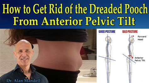 How To Get Rid Of The Dreaded Belly Pooch From Anterior Pelvic Tilt