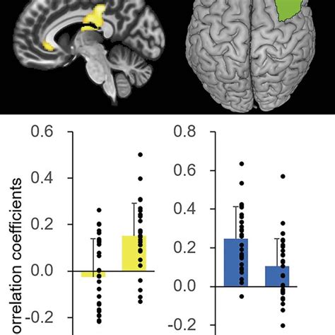 Seed Based Analysis For Resting State Fmri The Seed Is The Left