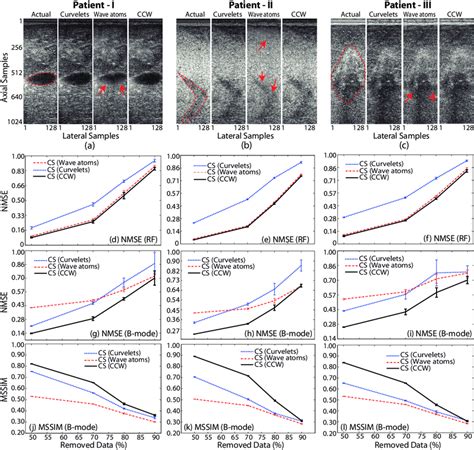 Illustration Of The Rf Data Reconstruction Performance Of Different Download Scientific Diagram