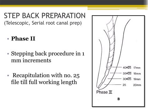 Cleaning And Shaping Of Root Canal Systems Pptx