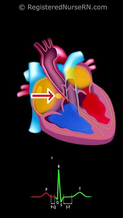 Cardiac Conduction System Electrical Signal Animation With Ecg Ekg Waveform Youtube